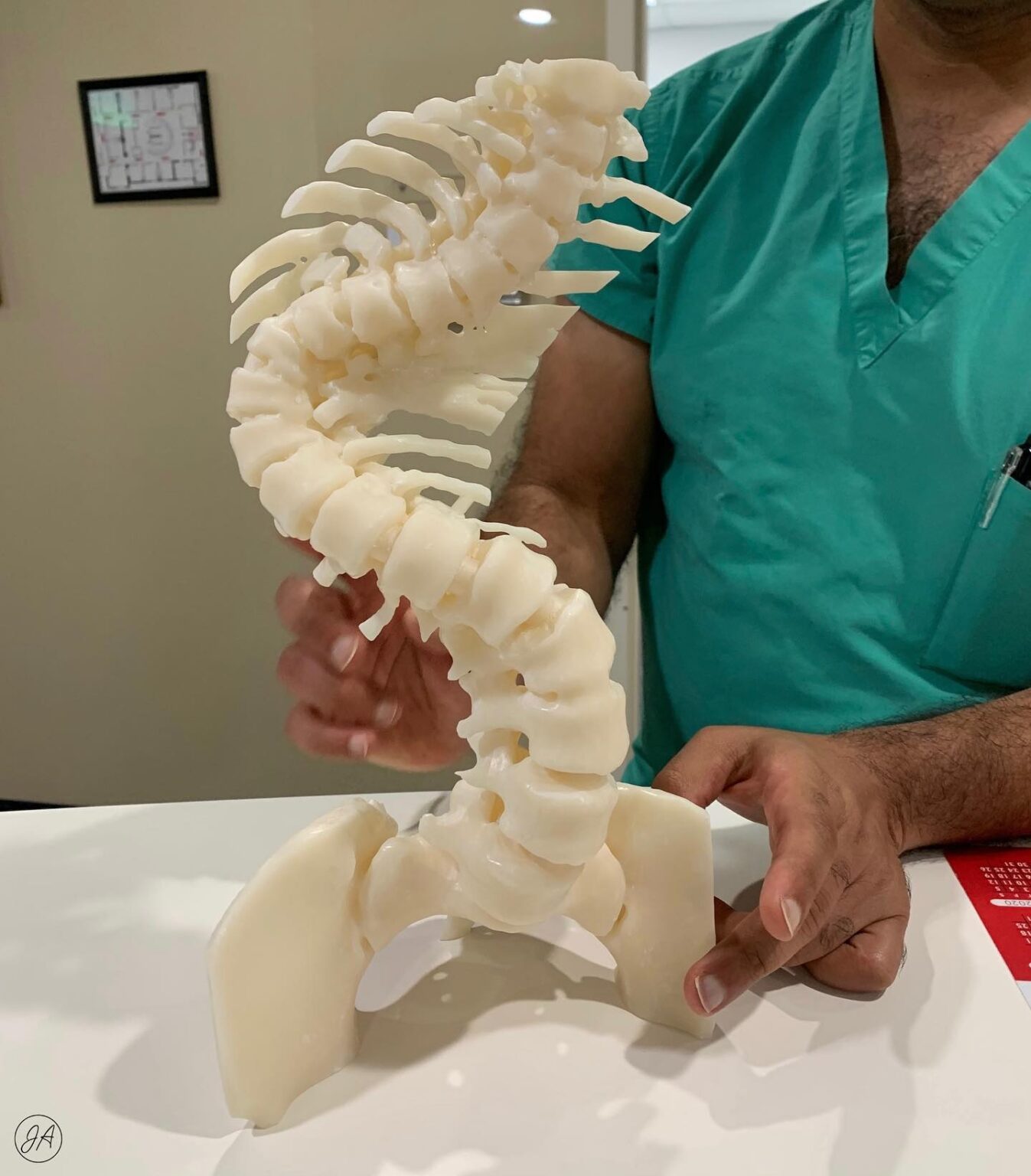 Personalized Surgery - South Florida Spinal Surgeon: Scoliosis, Complex ...