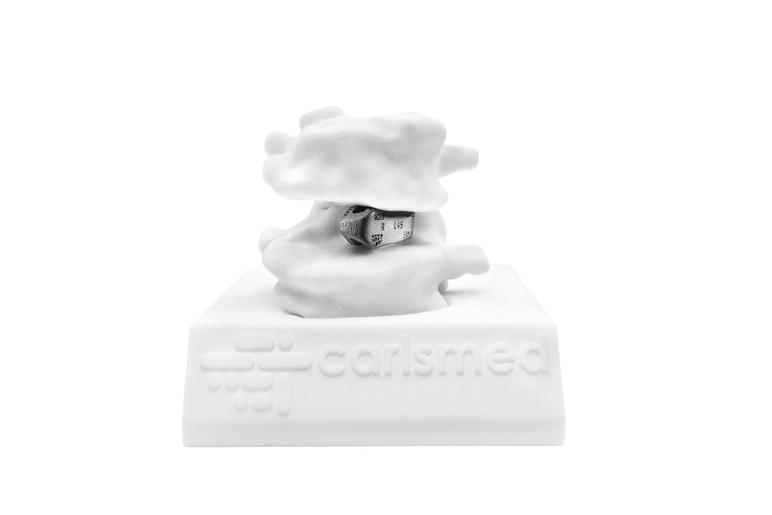 Personalized Surgery - South Florida Spinal Surgeon: Scoliosis, Complex ...